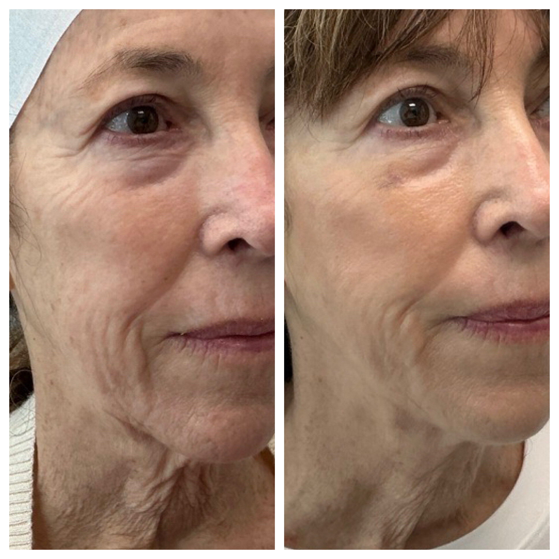 Before and After ~ See the results
